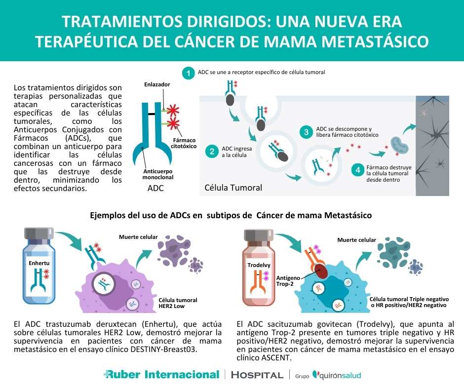 Anticuerpos Conjugados con Fármacos (ADCs): Avances en el tratamiento del cáncer de mama metastásico
